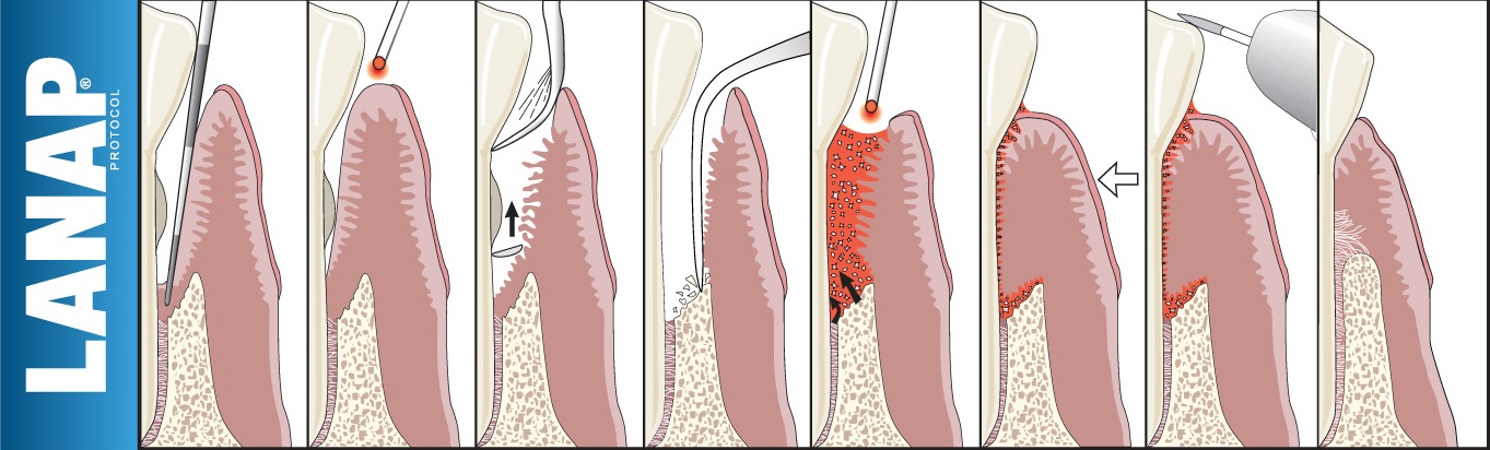 Services – NK Perio & Implants
